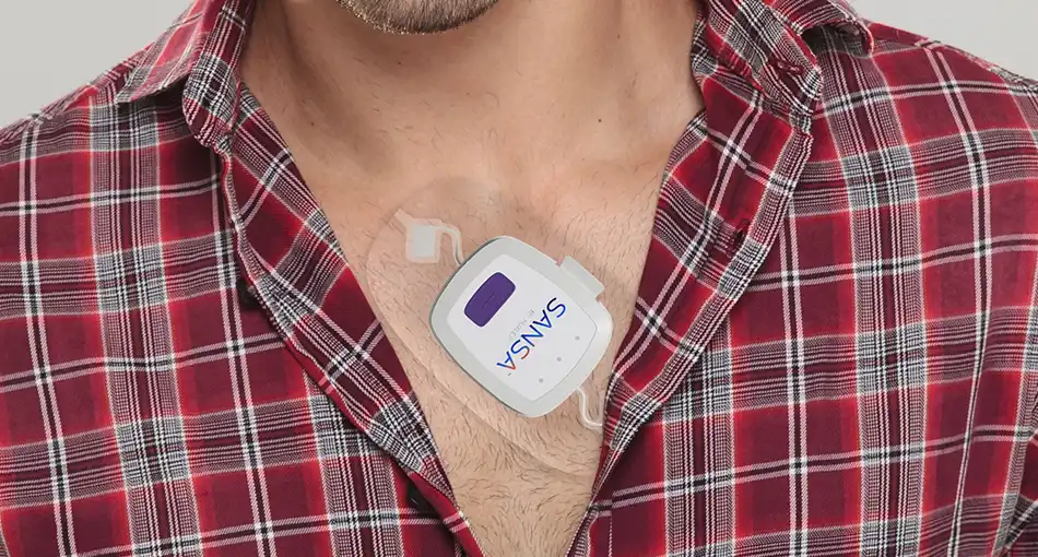 Transforming Sleep Disorder Diagnostics: The Impact of SANSA on Sleep ...